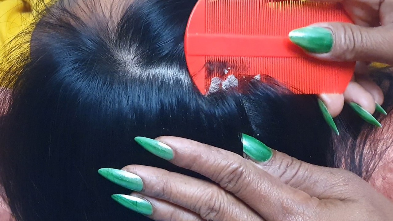 Close Up ASMR 👀 Long Hair Scalp Check  Peaceful Soothing Sounds C0029