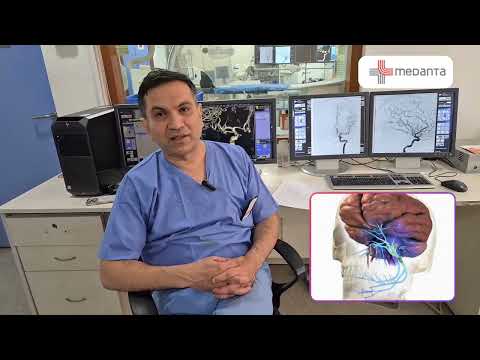 What is Digital Subtraction Angiography (DSA) Test ?