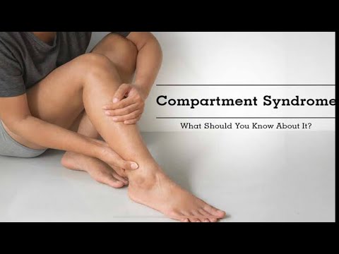 COMPARTMENT SYNDROME - Definition,Pathophysiology, Causes, Clinical Features,Diagnosis and Treatment