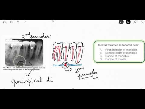 MENTAL FORAMEN