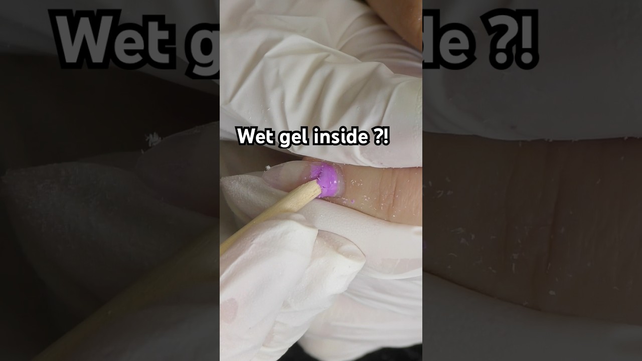 Her nails were so thick 😲