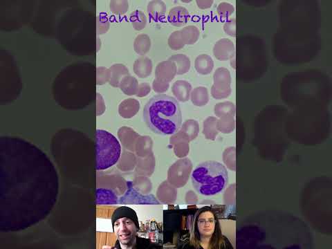 Band Neutrophil Morphological Characteristics
