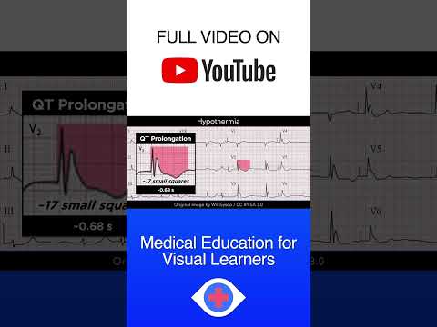 Hypothermia ECG #shorts
