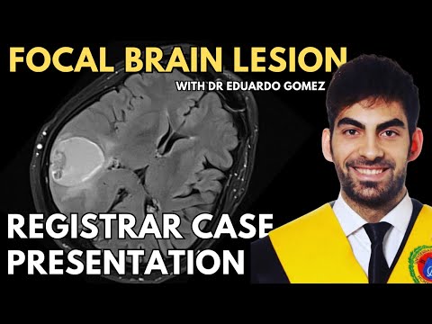 Focal Brain Lesion | Neuroradiology | Registrar Sessions