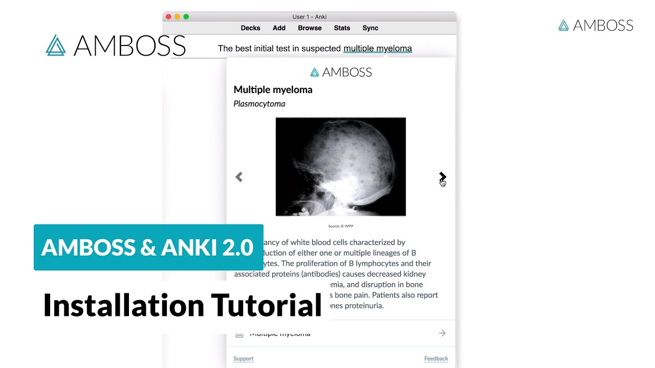 Installation Tutorial: Anki x AMBOSS Add-on