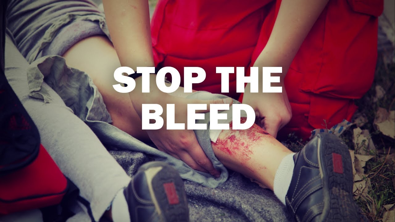 Application of Bleeding Control Methods in Community Settings