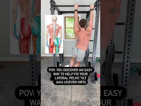 POWERFUL Lateral Pelvic Tilt Correction Exercise