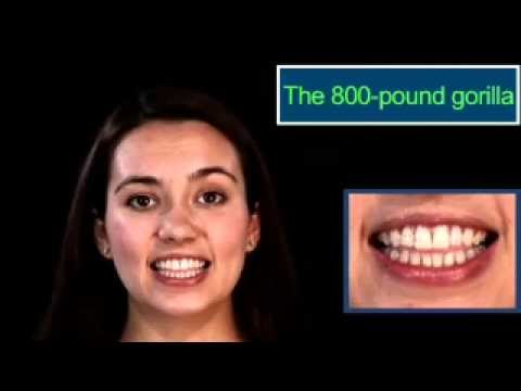 American Slang & Idioms - THE 800-POUND GORILLA