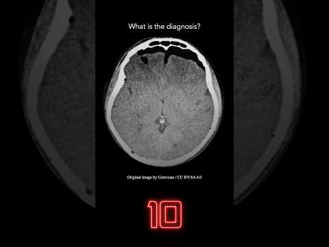 Brain CT Question 11