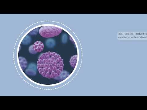 CCL2 inducing M1 polarization of lung macrophages – Video abstract [506693]