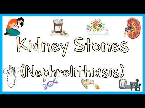 Kidney Stones(Nephrolithiasis) Causes, Pathophysiology, Signs & Symptoms, Diagnosis , Treatment
