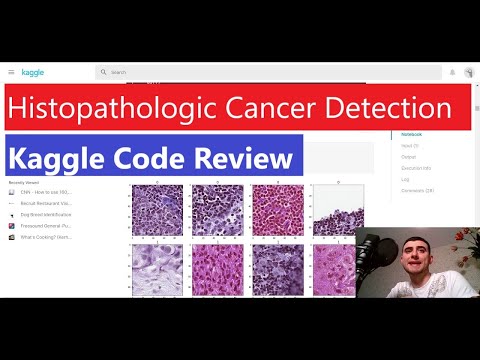 Histopathologic Cancer Detection | Kaggle Code Review