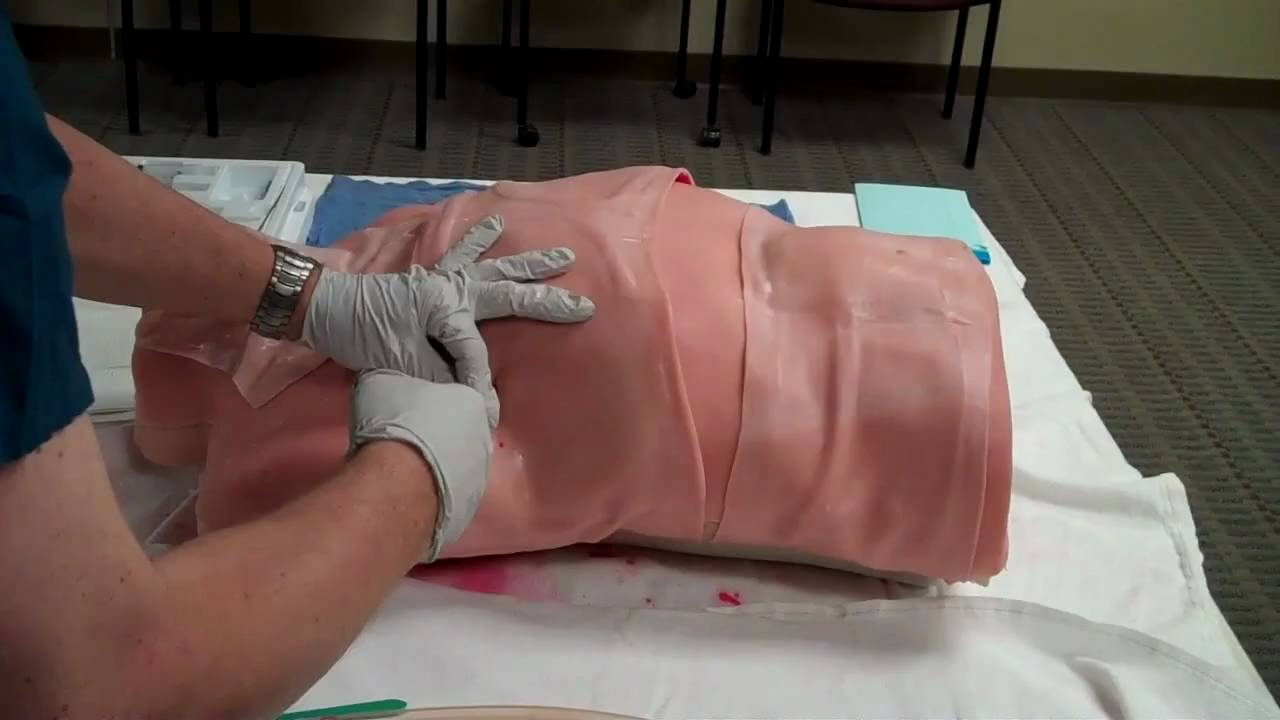 Chest Tube for Trauma