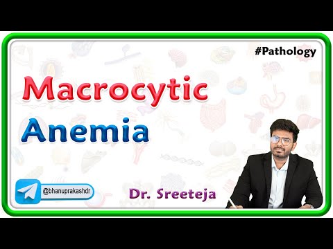 4. Macrocytic Anemia | USMLE Step 1 Pathology