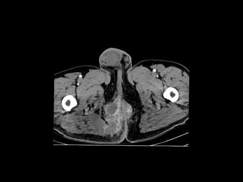 35-❓️🤔QUIZ-1:👉What do you think about this patient?‼️Subscribe to my Instagram page for the answer‼️