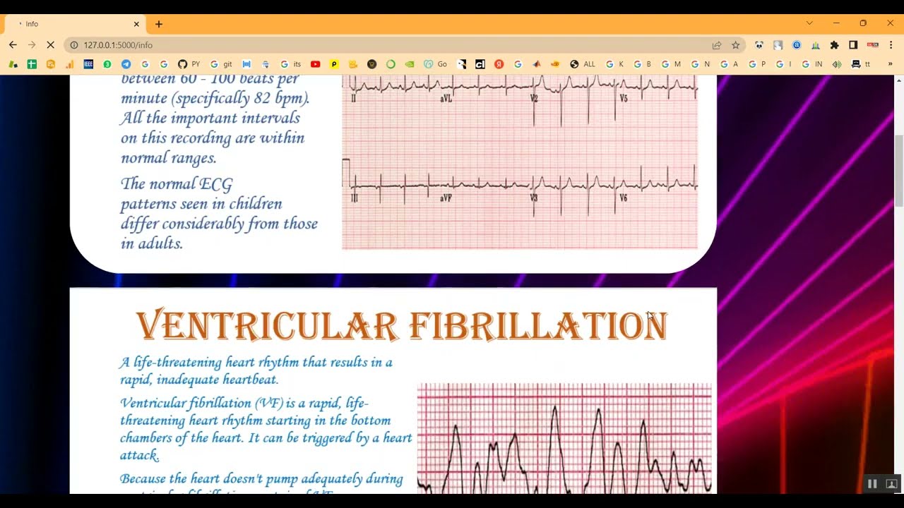 Siamese Convolutional Neural Network for Heartbeat Classification Using Limited 12 Lead ECG ...