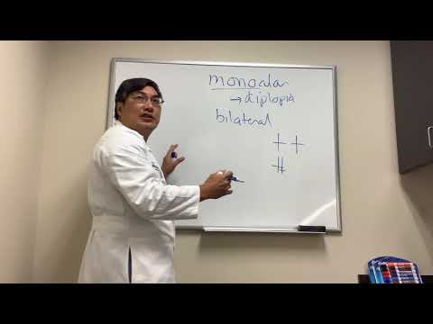 Monocular Diplopia