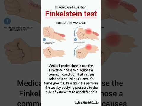 Finkelstein test | De Quervain's syndrome | #viralvideo #finkelstein #quervain #test