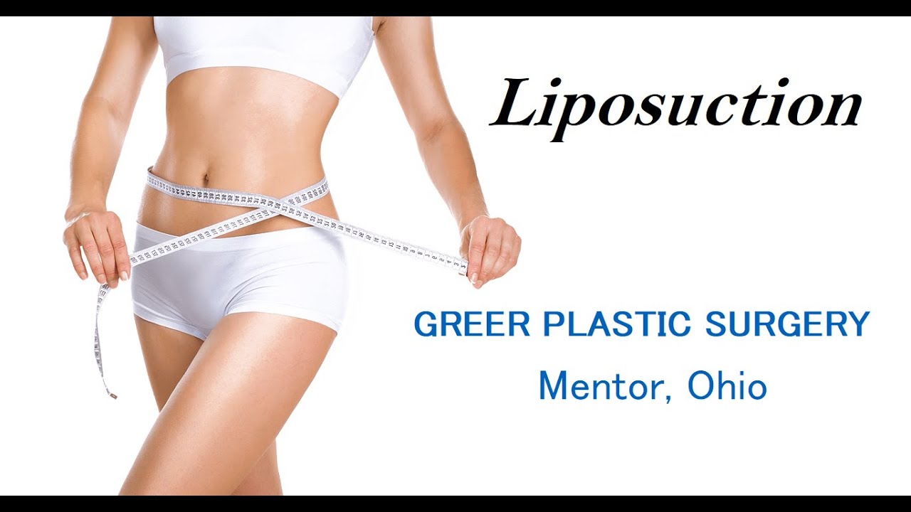 What is Liposuction? | A Doctor Answers | Greer Plastic Surgery