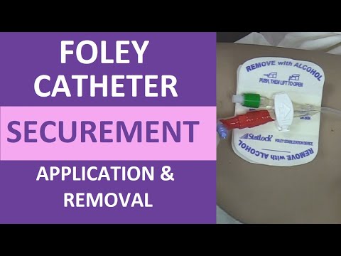 Foley Catheter: How to Secure with StatLock Stabilization Device (Apply & Remove Nursing)