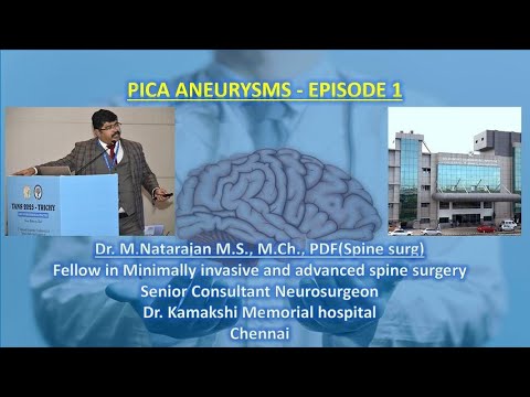 Dr. Natarajans brain and spine : PICA Aneurysms Episode 1
