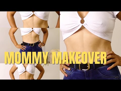 ¿Cómo es todo el proceso de una cirugía MOMMY MAKEOVER? / Mommy Makeover Surgery