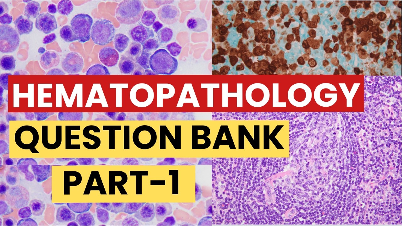 Hematopathology High Yield Board Review Question Bank Part-1
