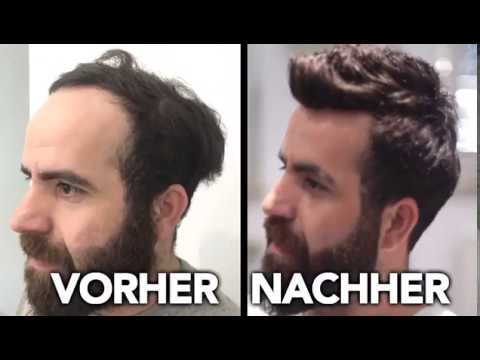 Zweithaarsystem/Haarersatz bei Hairtec GmbH