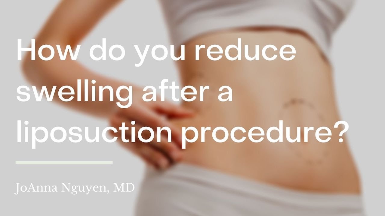 How do you reduce swelling after a liposuction procedure?