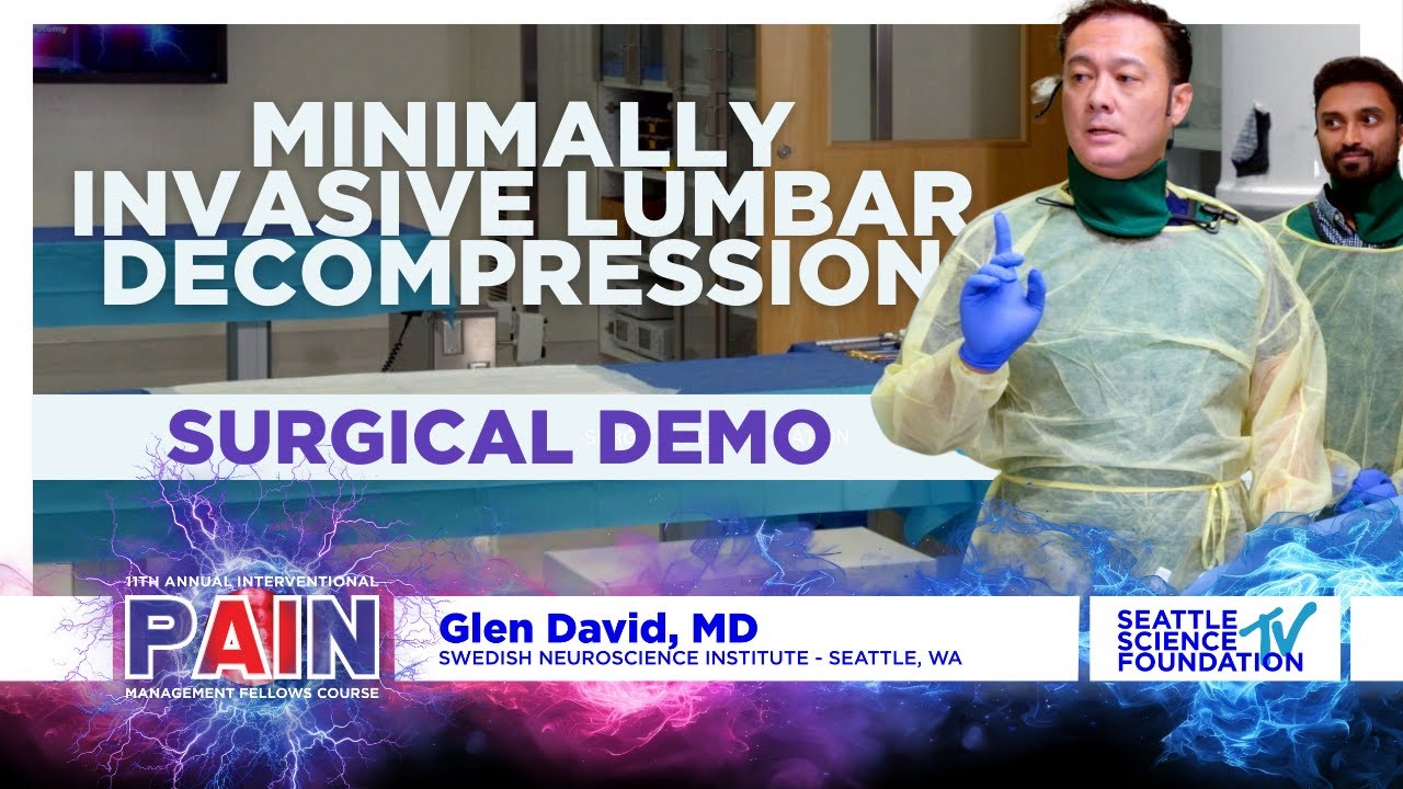 Minimally Invasive Lumbar Decompression - Glen David, M.D.