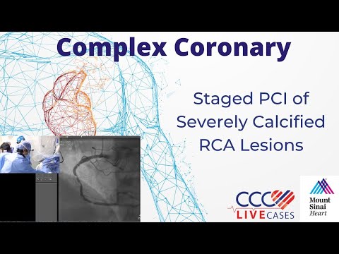 Staged PCI of Severely Calcified RCA Lesions - November 20, 2018