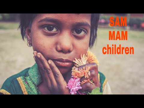 Full Form Of SAM And MAM||कुपोषित बच्चे 2021||Abbreviation||#shorts#