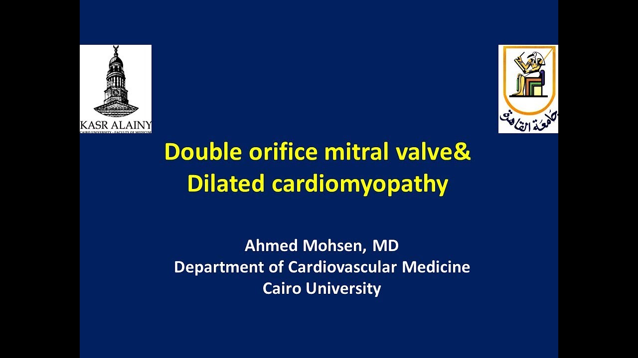 Double orifice mitral valve(DOMV)