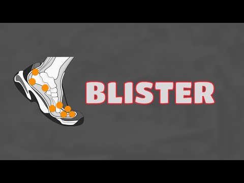 What Does BLISTER Means || Meanings And Definitions With Example in ENGLISH