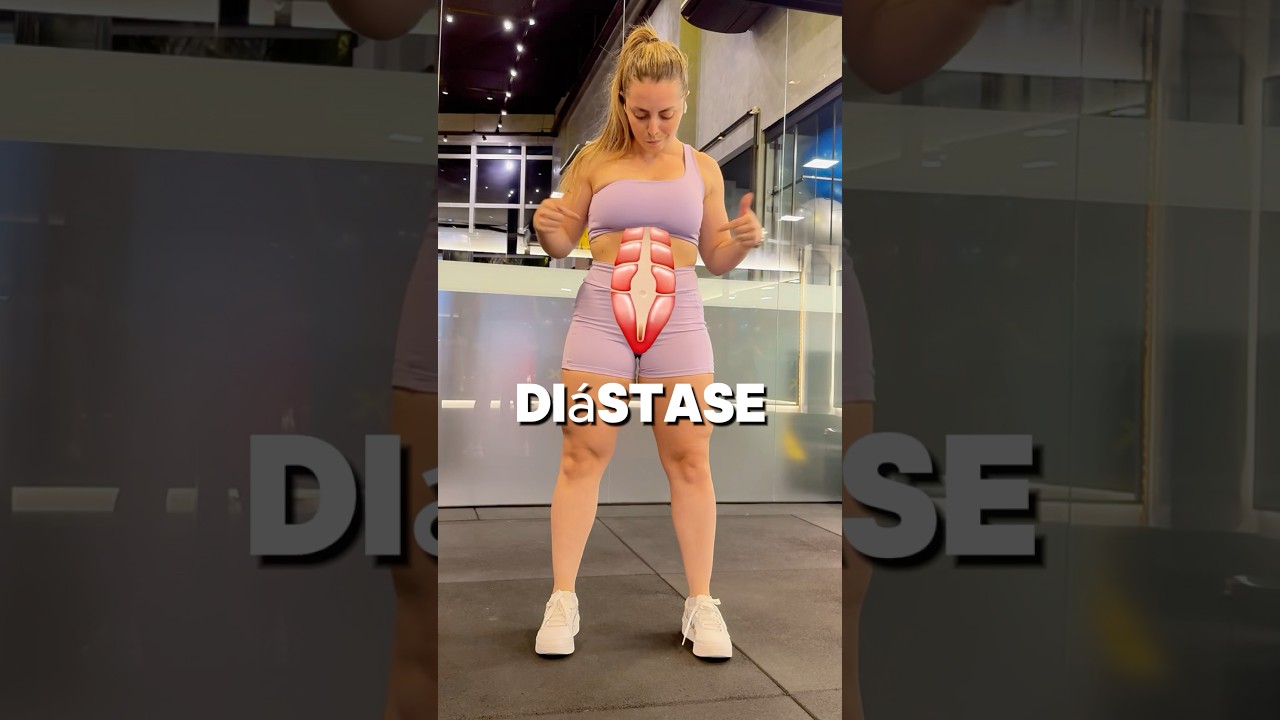 Se você têm DIÁSTASE faça isso 😱🔥 #abdominal #diastase #diastaseabdominal