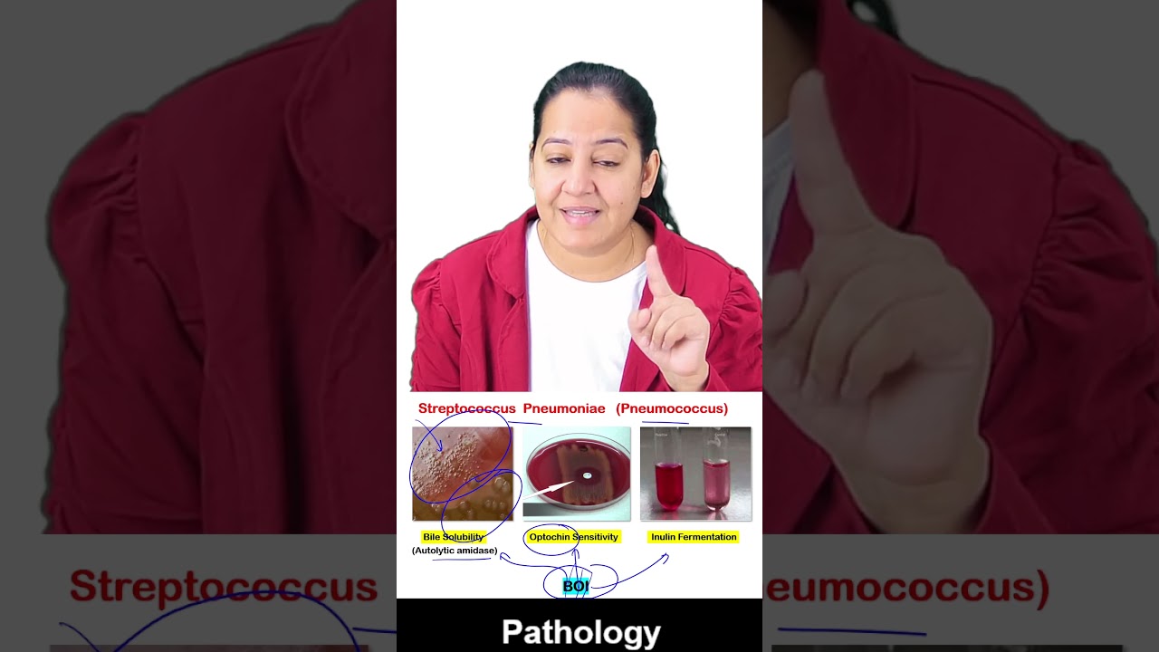 1 minute learning:   Pneumococcus   Biochemical properties