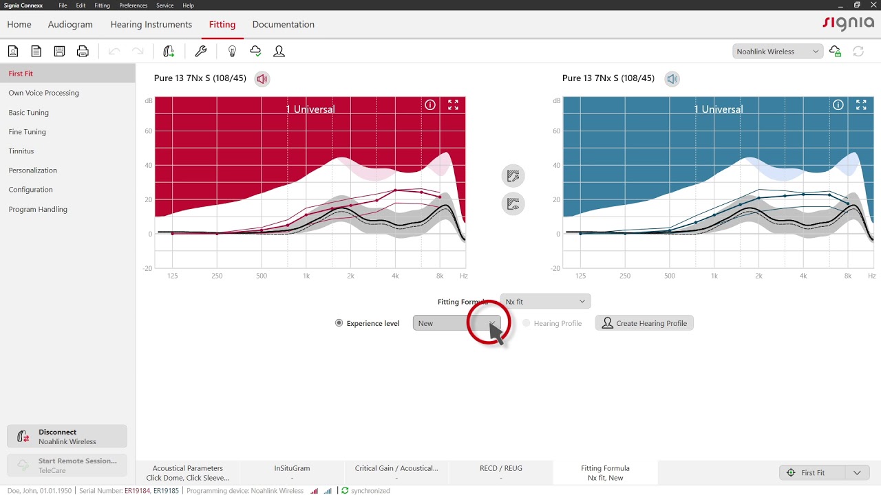 Connexx Software Download Link for Signia Hearing Aid - Hearing Aid ...