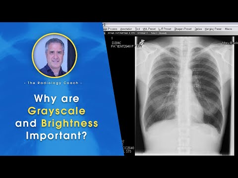 Why are GRAYSCALE and BRIGHTNESS Important??