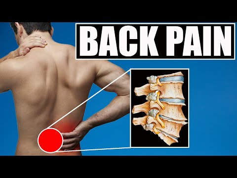 How to get Rid of Back Pain (Best Stretches l Exercises l Treatment)