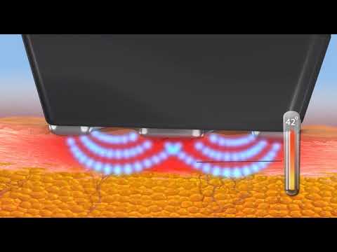 How Does Skin Tightening Work?