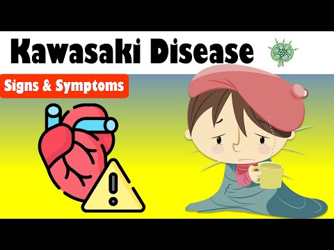 Kawasaki Disease - Signs & Symptoms |What Are The Major Signs & Symptoms Of Kawasaki Disease