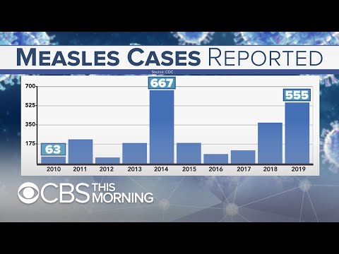 Behind the latest spike in measles cases