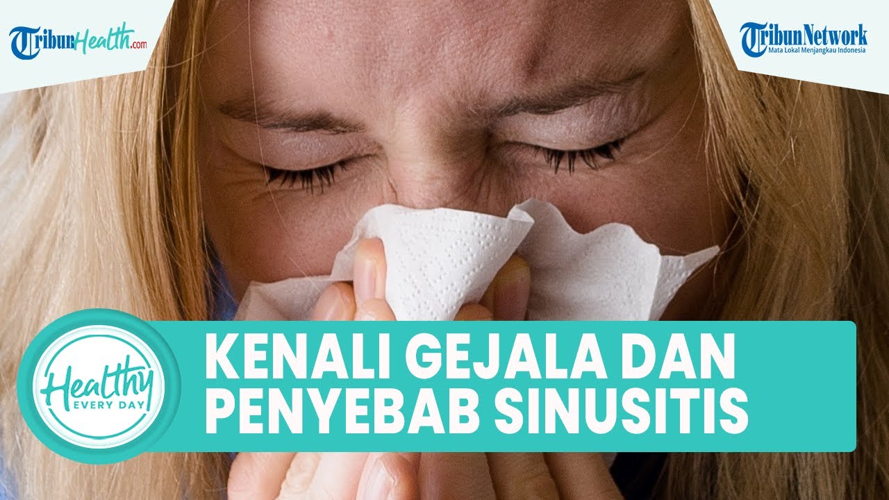 Kenali Gejala dan Penyebab Sinusitis, dari Hidung Mampet hingga ...