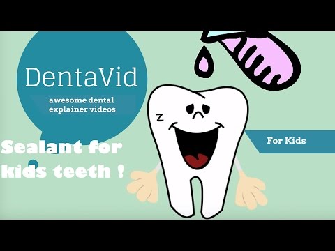Sealant for kids teeth - Dental sealants for children - Explainer Video for Kids
