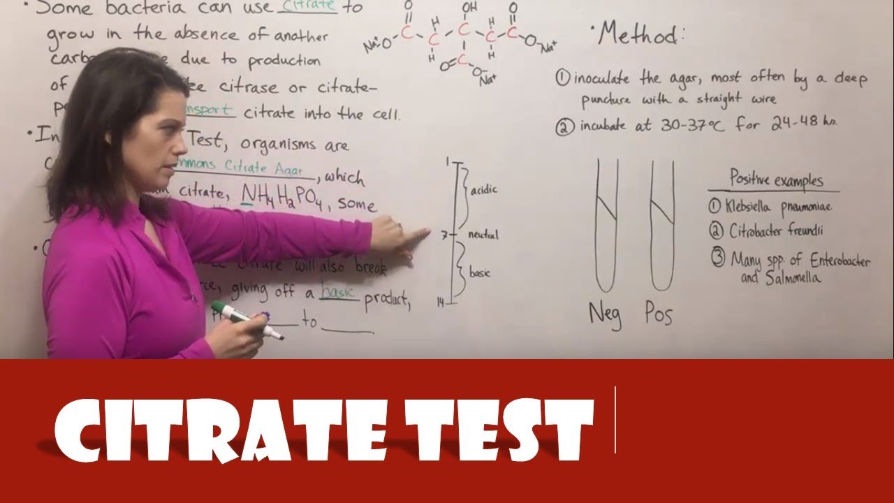 Citrate Test