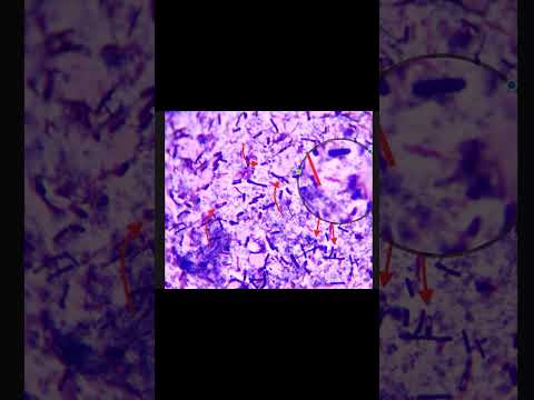 Diarrhea in dogs | Clostridium | Bacteria