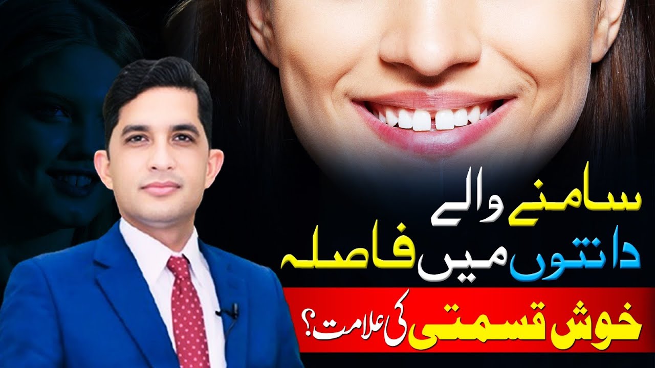 Gap Between Front Teeth: Lucky or Not? | Islamic Learning Hub