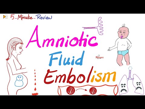 Amniotic Fluid Embolism - ObGyn Pathology Lectures | 5-Minute-Review Series