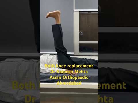 Best orthopedic doctor knee replacement nearme Dr Kalpesh Mehta Asian orthopedic Ahmedabad9879517351