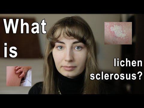 Lichen sclerosus: what is it? Where does LS come from?